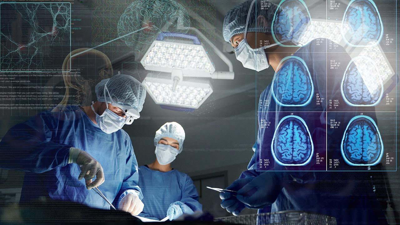 Operacja guza mózgu przez oczodół. Mózg o niej nie wie [WIDEO] | TVP INFO